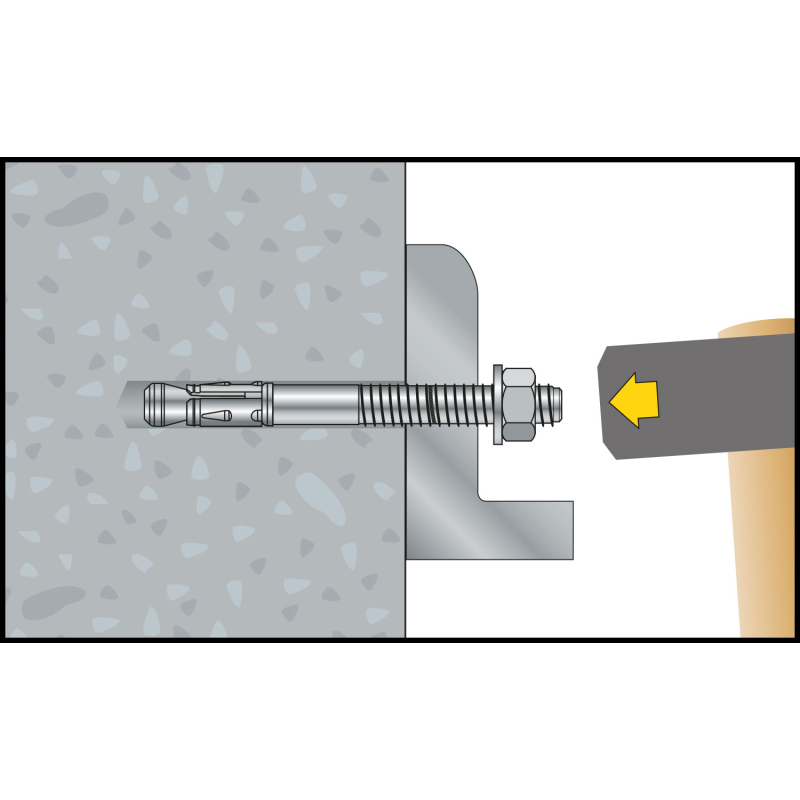 Quick-fix anchor BAZ plus